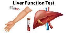 Liver Function Test At Rs 500 In Bolangir ID 6650783 Aditya Healthcare Diagnostics