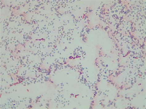 Mycobacterium Smegmatis Gram Stain 1000x