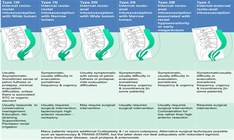 Ods Classification Of Iri