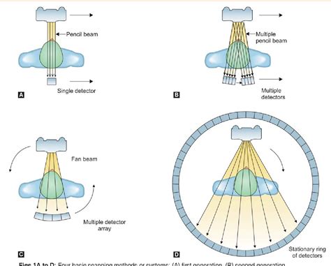 Ct Scanner Schematic