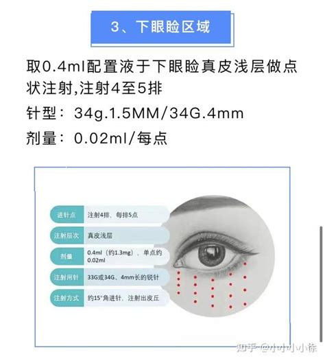 薇旖美4mg新手科普产品介绍，含使用方法 知乎