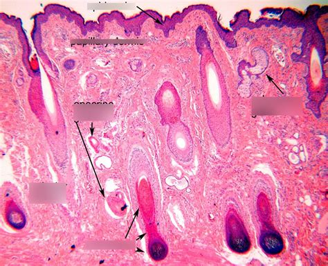 76a Cutaneous Glands Sebaceous Diagram Quizlet