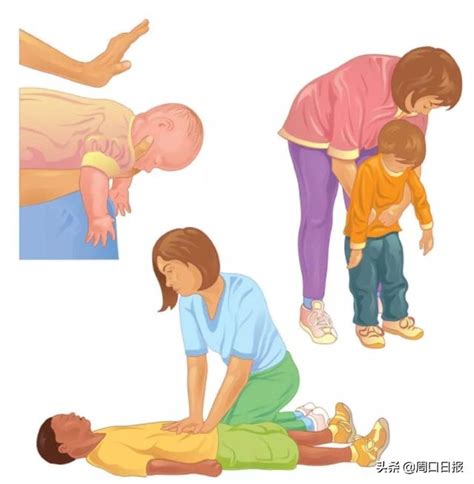 周口市中心醫院多學科協作，成功救治一例氣道異物導致呼吸衰竭患兒 每日頭條