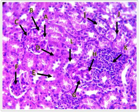 Renal Cortex A Vaculation Of The Glomerulus B Intraglomerular