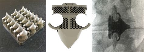 Tsunami Medical Expands Ge Additive Metal 3d Printing Fleet For Spinal