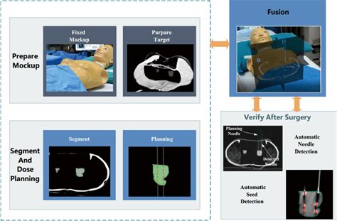 The Flow Of Phantom Experiment Download Scientific Diagram