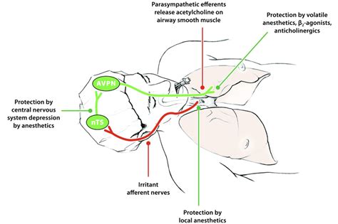 Severe Bronchospasm After Induction In Obese Female Anesthesia Experts