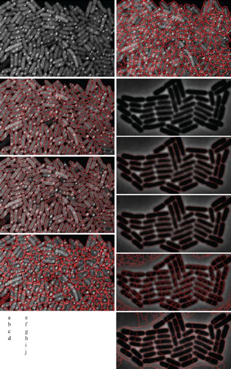 Segmentation Comparison Result Fluorescent Protein Labelled E Coli Download Scientific