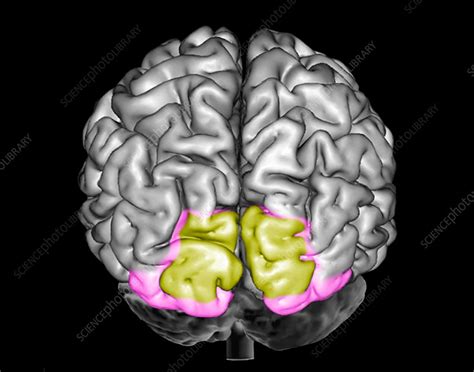 Human Brain Visual Cortex 3d Mri Scan Stock Image C036 6975