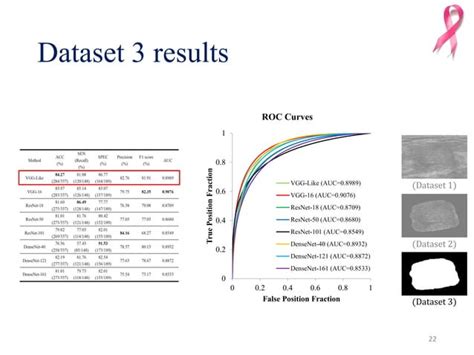 Computer‐aided Diagnosis Of Breast Cancer Using Ensemble Convolutional Neural Networks