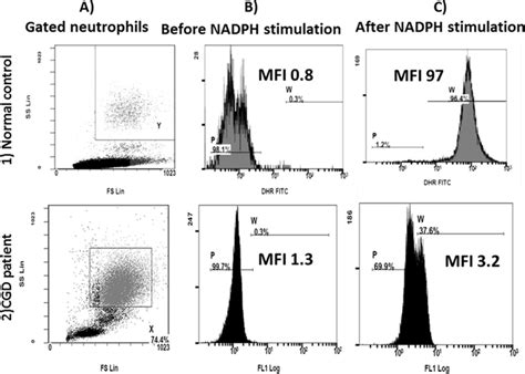 Dihydrorhodamine Assay On Flow Cytometry In A Normal Control 1 And A