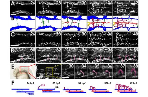 Two Photon Time Lapse Imaging Of The Assembling Hindbrain Vasculature Download Scientific