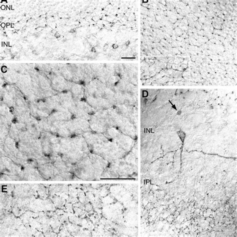Nk1 Receptor Immunoreactive Amacrine Cells In A Horizontal Section In