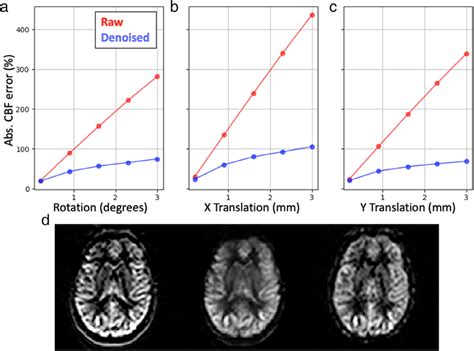 Simulation Of Motion Artifacts Before And After Application Of The Dae