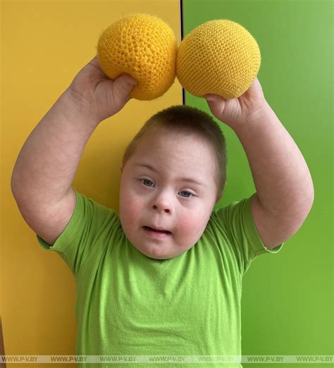 ≡ 21 марта Международный день человека с синдромом Дауна все что нужно знать Пiнскi Веснiк