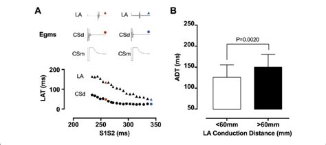 Components Of Intra Atrial Conduction Delay Download Scientific Diagram