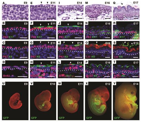 Jci Periderm Prevents Pathological Epithelial Adhesions During