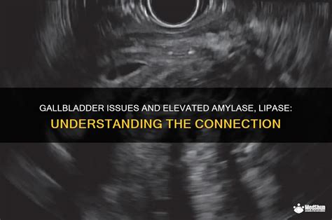 Gallbladder Issues And Elevated Amylase Lipase Understanding The