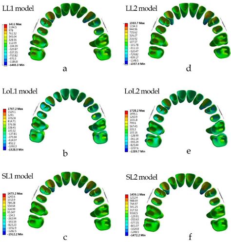 Figure 7 From Stress Distribution And Tooth Displacement Analysis Of