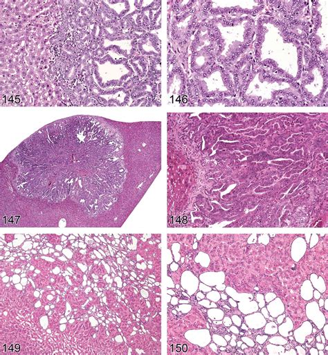 Mouse Liver Cholangioma Figure 146 Mouse Liver Cholangioma Higher Download Scientific