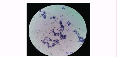 Gram Stain Was Done And It Was Gram Positive Cocci Arranged In Pairs Download Scientific