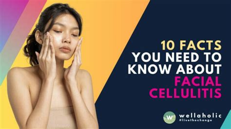 10 Facts You Need To Know About Facial Cellulitis