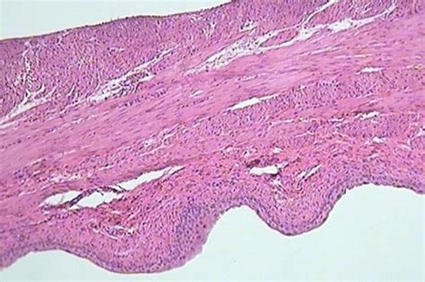 Urinary Sys Histology Flashcards Quizlet