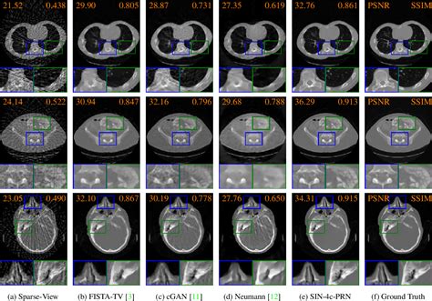Figure 1 From 2 Step Sparse View Ct Reconstruction With A Domain Specific Perceptual Network