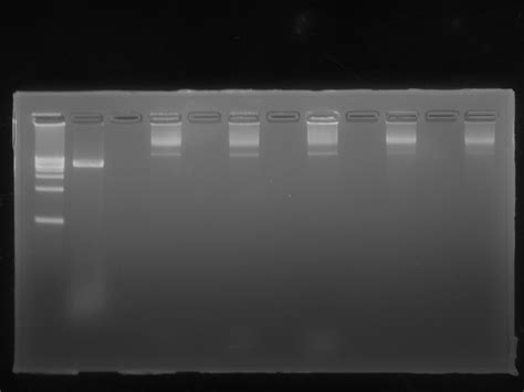 I Have The Wrong Size Of Plasmid After Ligation What Could Have Happened Researchgate