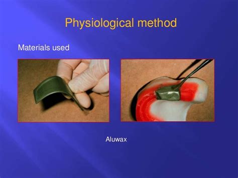 Methods Of Recording Centric Jaw Relation Ppt At Neal Marquez Blog