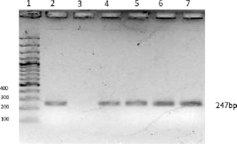 Figure 1 From Molecular Detection Of Clostridium Perfringens Type D