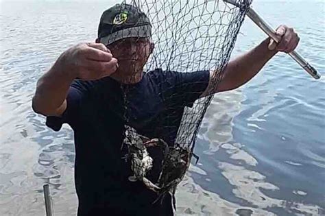 Nj Man May Need Limbs Amputated After Contracting Flesh Eating Bacteria
