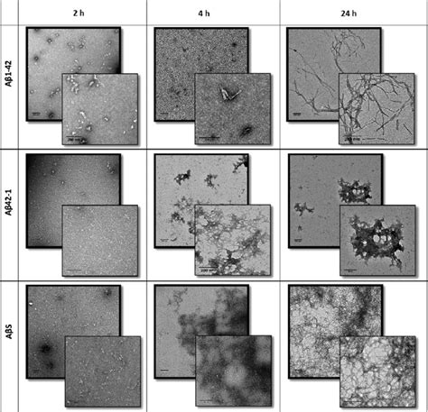 Negative Stain Transmission Electron Micrographs With Magnified Images