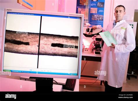 Forensic Hair Analysis Forensic Scientist Using A Microscope To Analyse Two Fibres On Screen