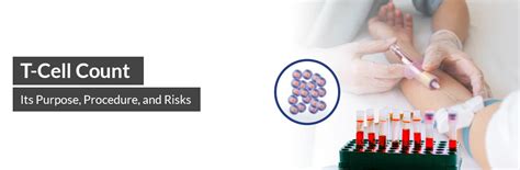T Cell Count Its Purpose Procedure And Risks