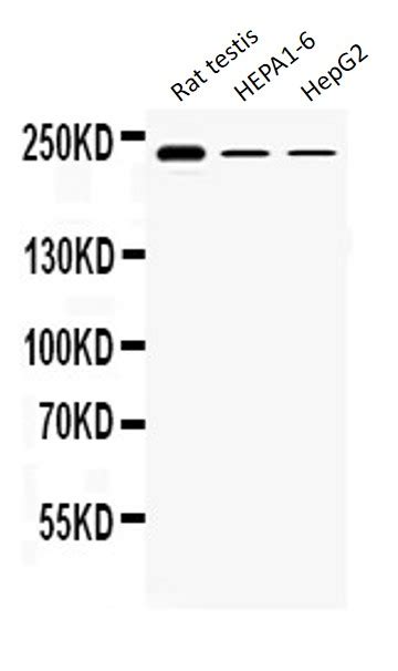 Anti Tecta Tectorin Alpha Antibody Arg59307
