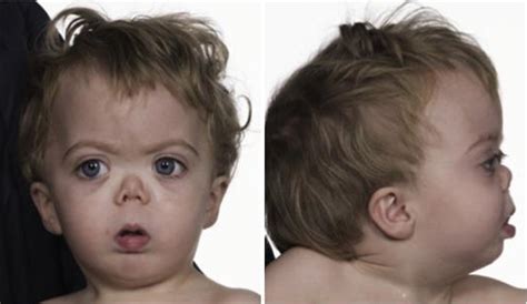 And Congenital Anomalies Ento Key