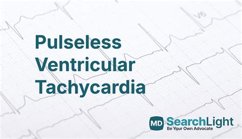Pulseless Ventricular Tachycardia MD Searchlight
