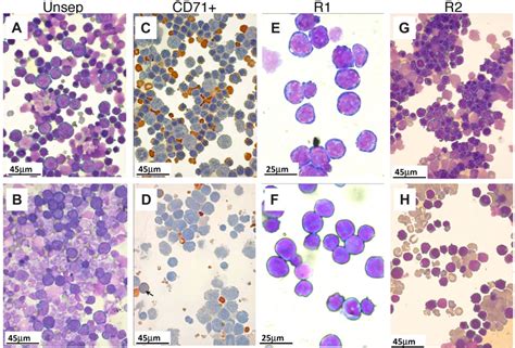 Morphologic Appearance Of Erythroid Cells In Spleen After Phz Download Scientific Diagram