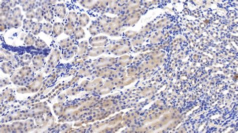 Polyclonal Antibody To Complement 1 Inhibitor C1inh Polyclonal
