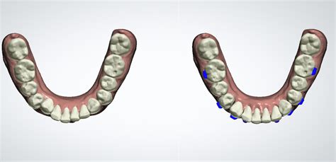 Model Beforeafter