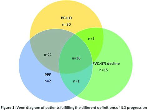 Pos1291 Prediction Of Mortality In Ssc Ild Depends On Definition Of Ild