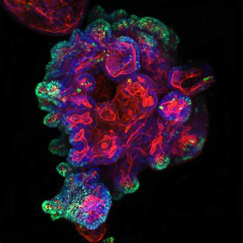 Artwork Intestinal Organoid Microscopy Sciart Bioart