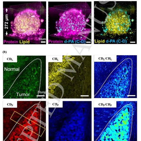 Raman Tagged Srs Imaging Of Lipid Metabolism In Cancer A