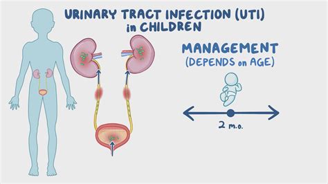 Urinary Tract Infection Pediatrics Clinical Sciences Osmosis Video