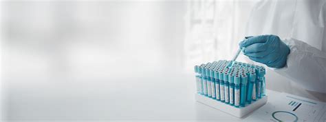 화학 반응을 위한 화학 연구를 수행하는 실험실 실무자가 화학 실험을 수행하고 환자의 혈액 샘플을 검사합니다 의학 및 연구 개념 30 34세에 대한 스톡 사진 및 기타 이미지