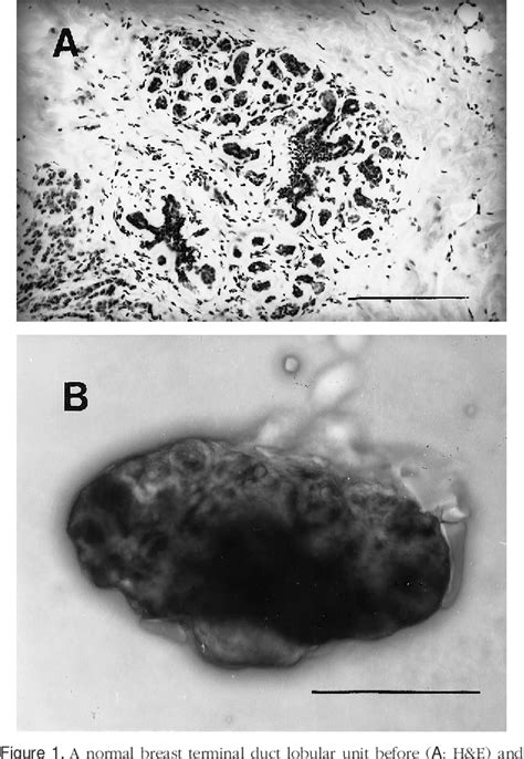 Figure 1 From Analysis Of Mrna From Microdissected Frozen Tissue Sections Without Rna Isolation