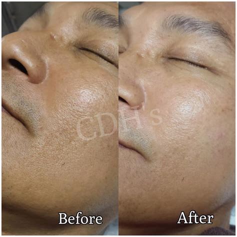 คุ ณ เ ห็ น ค ว า ม แ ต ก ต่ า ง ข อ ง ผิ ว มั้ ย ด้วยความลับของcdhs ที่มีลักษณะเด่น ทำให้ผิว