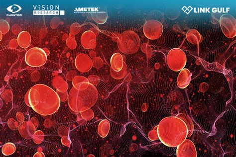 Early Sepsis Detection With Phantom High Speed Cameras