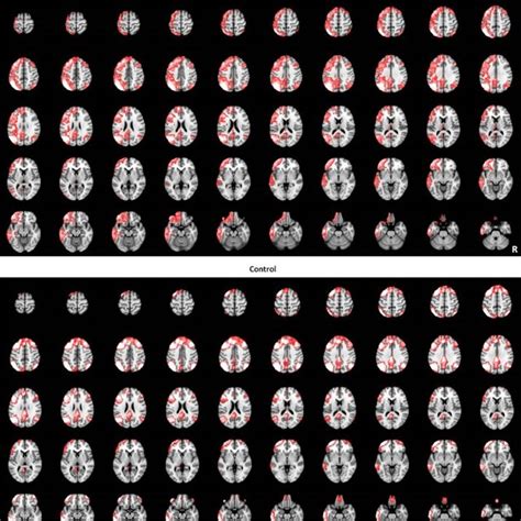 A B Graphical Presentation Of The Left Frontoparietal Network In Download Scientific Diagram